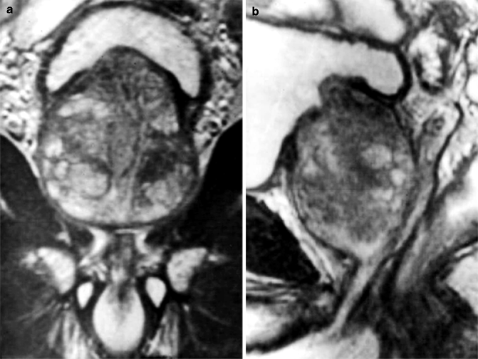 Anatomy: Anatomic Considerations for Efficiency and Precision in ...