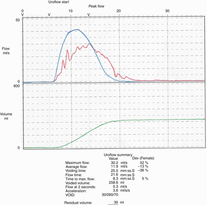 Urodynamics: The Practical Aspects | Abdominal Key