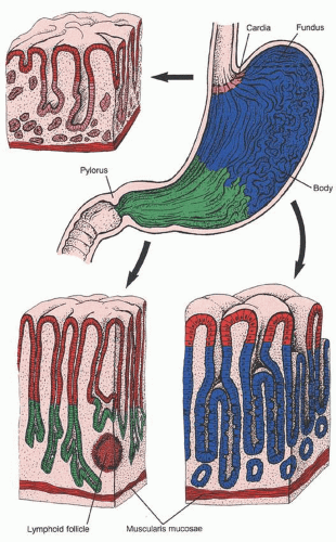 The Nonneoplastic Stomach | Abdominal Key