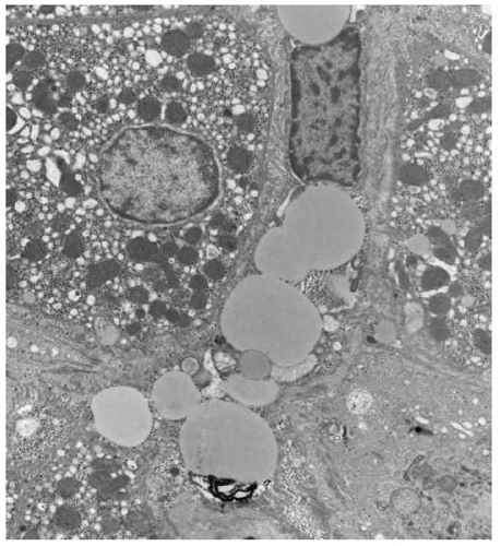 Electron Microscopy | Abdominal Key