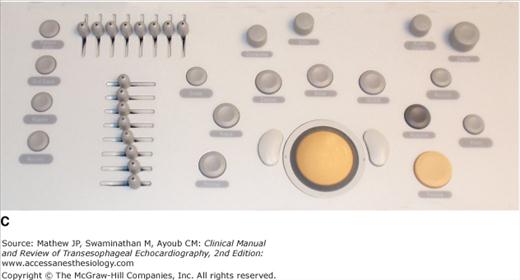 Understanding Ultrasound System Controls | Anesthesia Key