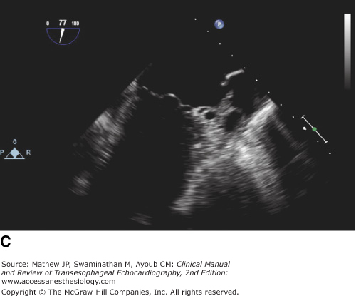Understanding Ultrasound System Controls | Anesthesia Key