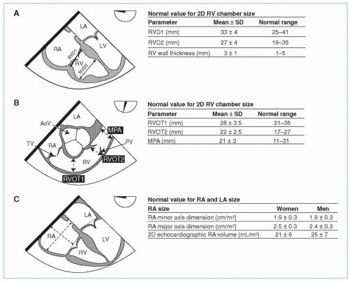 Right Ventricle, Right Atrium, Tricuspid and Pulmonic Valves ...