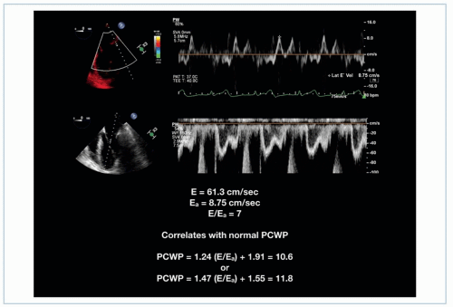 Quantitative Doppler and Hemodynamics | Anesthesia Key