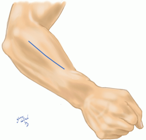 Forearm Vessels | Basicmedical Key