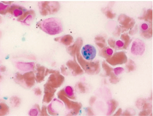 Lymphocytes and Plasma Cells | Basicmedical Key