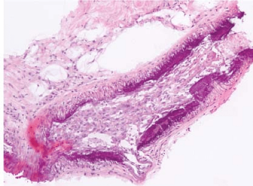 The Skin | Basicmedical Key