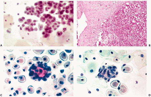 Rare and Unusual Disorders of the Female Genital Tract | Basicmedical Key