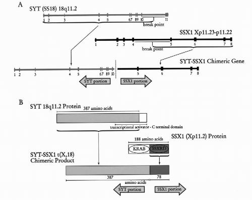 Soft Tissue Lesions | Basicmedical Key