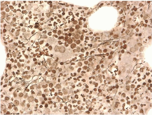 Erythrocytes | Basicmedical Key