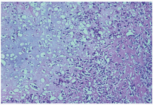 Periosteum | Basicmedical Key