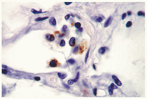 Rickettsia and Related Organisms | Basicmedical Key