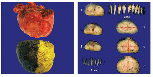 Prostate, General Concepts | Basicmedical Key