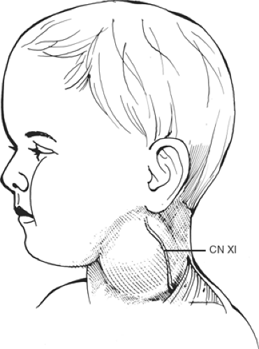 Congenital Lesions: Thyroglossal Duct Cysts, Branchial Cleft Anomalies ...