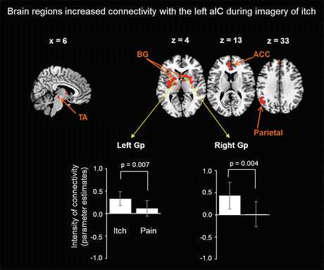 of Itch as a Tool of Assessment of Chronic Itch and Its Management ...