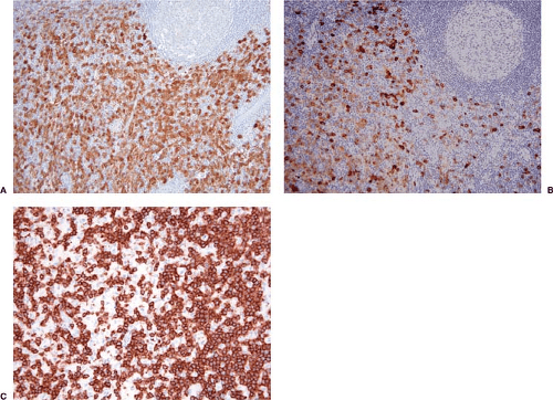 Dermatopathic Lymphadenopathy | Basicmedical Key