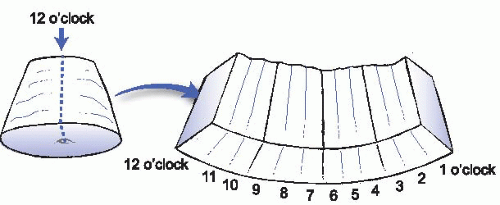 Uterine Cervix | Basicmedical Key