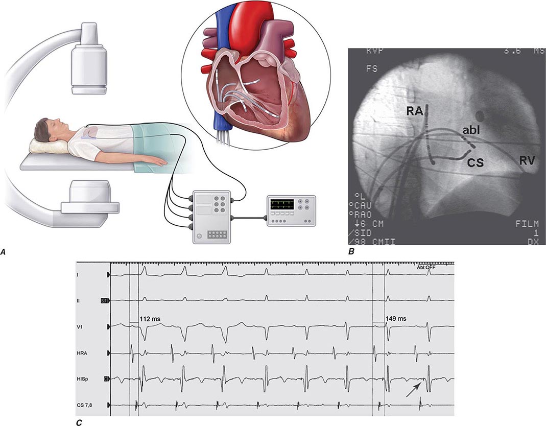 Atlas of Electrocardiography | Basicmedical Key