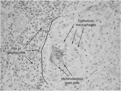 GENERAL CONCEPTS IN PATHOLOGY | Basicmedical Key