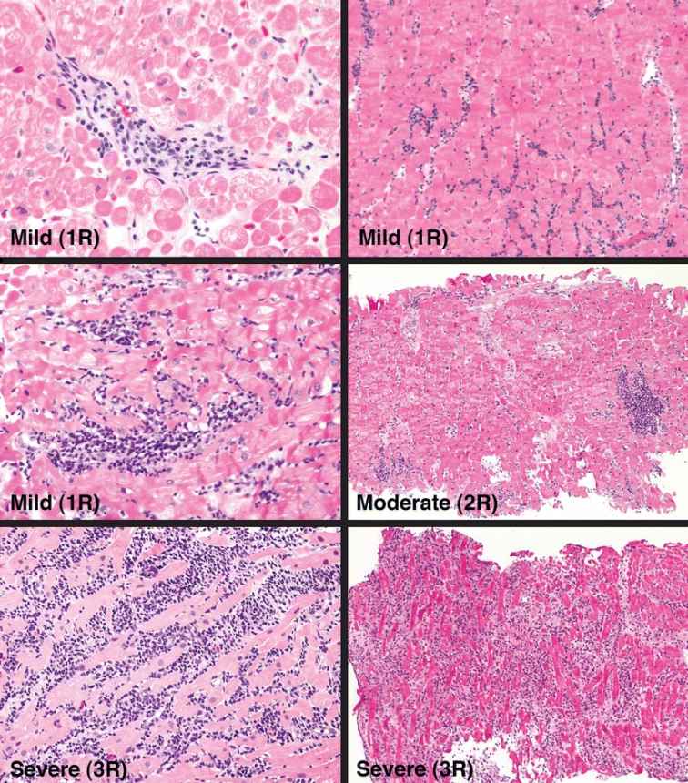 Heart | Basicmedical Key