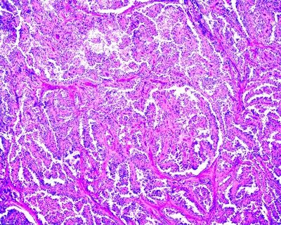Pancreas | Basicmedical Key