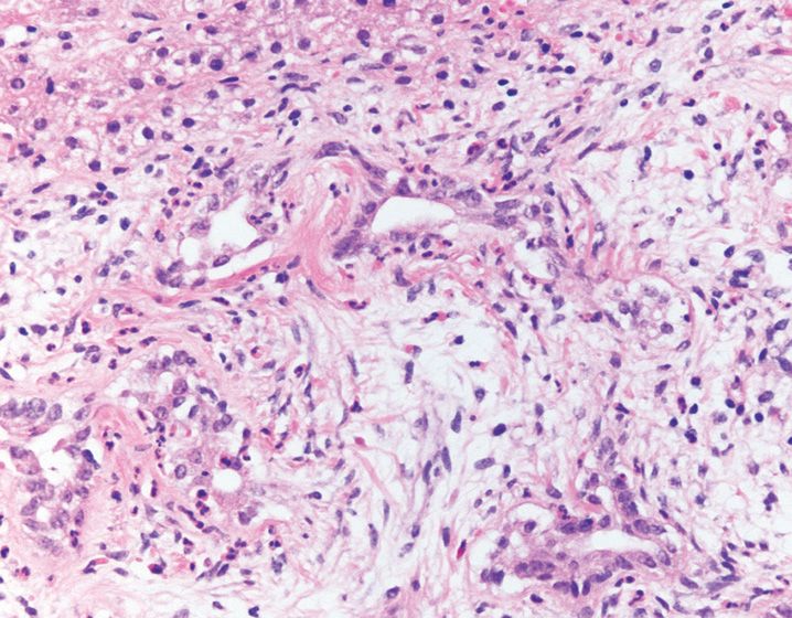 Gastrointestinal, Hepatobiliary, and Pancreatic Pathology ...