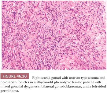 Nonneoplastic Diseases of the Testis | Basicmedical Key
