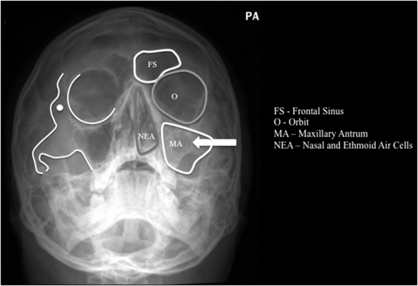 Facial x-ray | Basicmedical Key