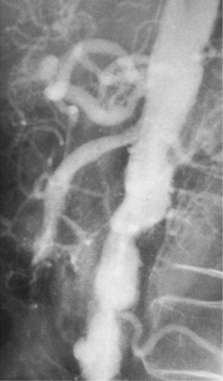 Small Bowel | Basicmedical Key