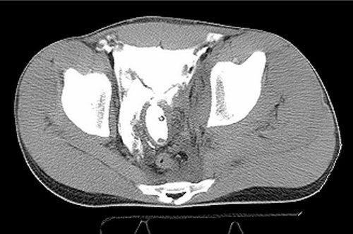 Trauma II: Traumatic Injuries | Basicmedical Key