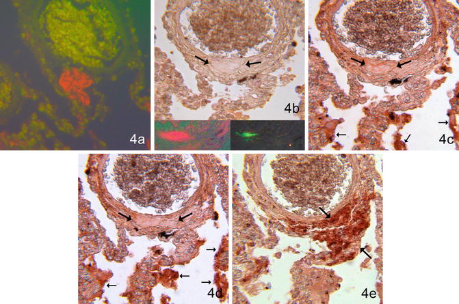 Typing of Amyloid for Routine Use on Formalin-Fixed Paraffin Sections ...