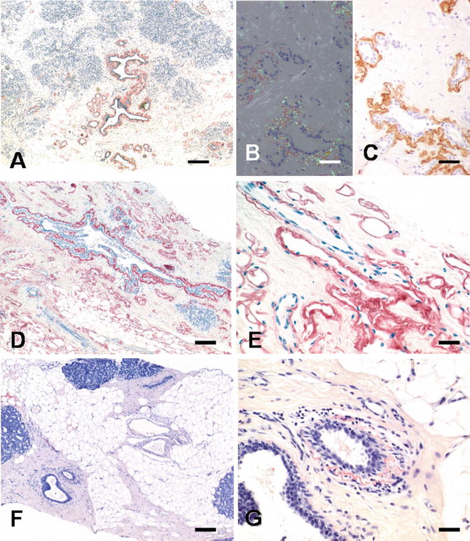 Amyloidoses of the Kidney, the Lower Urinary and Genital Tracts (Male ...