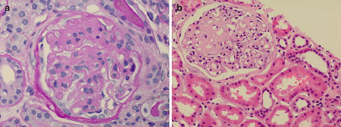 Differential Diagnosis of Amyloid in Surgical Pathology: Organized ...
