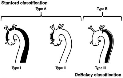 Chest and Back Pain | Basicmedical Key