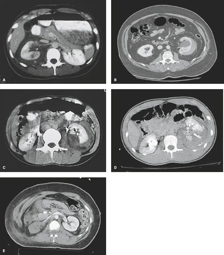 Genitourinary Trauma | Basicmedical Key