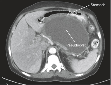 Pancreas Anatomy and Physiology | Basicmedical Key