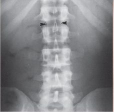 Back | Basicmedical Key