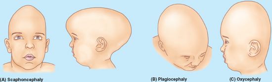 Head | Basicmedical Key