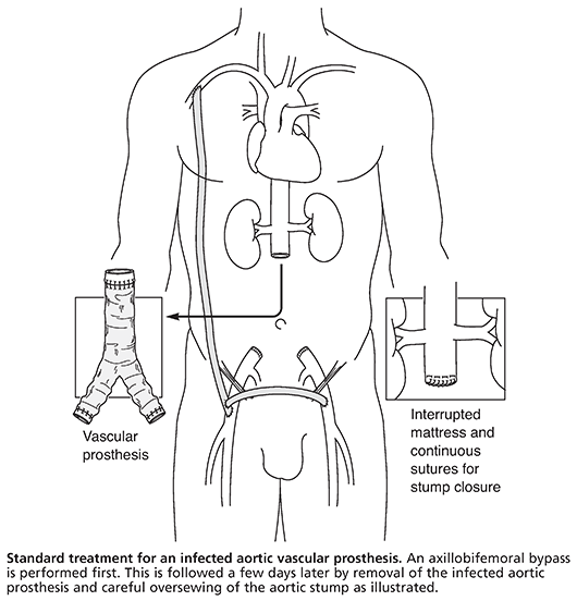 Vascular | Basicmedical Key