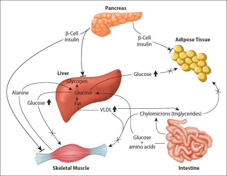 47 Diabetes Mellitus | Basicmedical Key