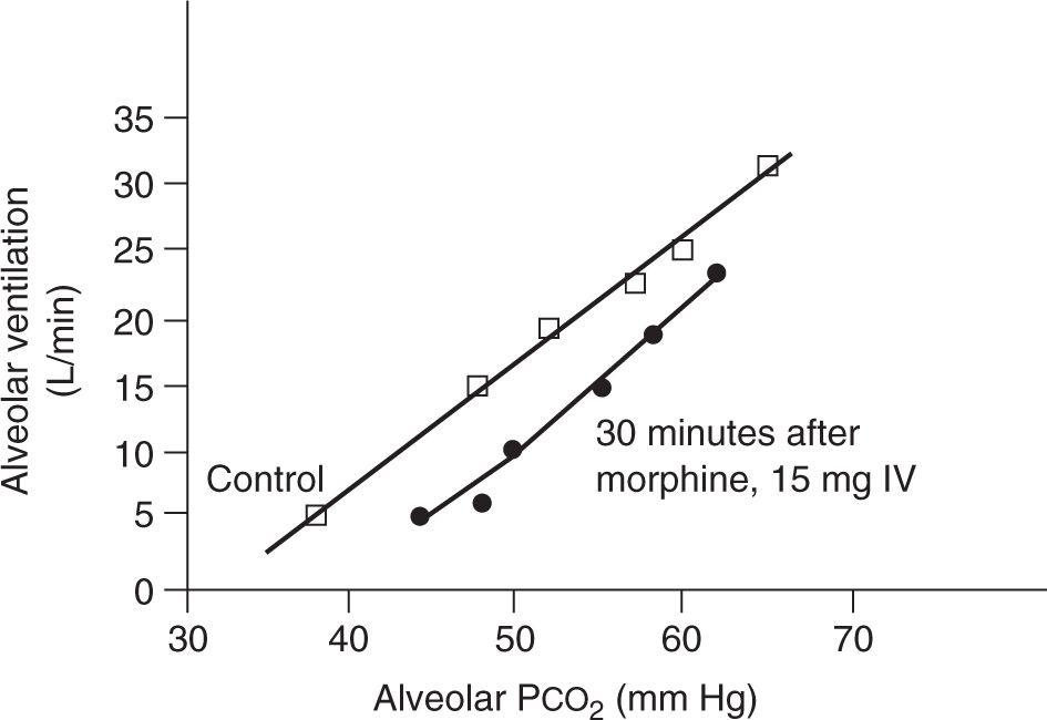 Anesthesiology | Basicmedical Key