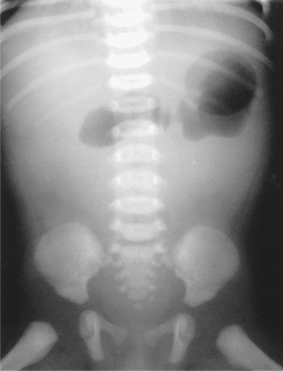 Pediatric Surgery: Surgical Diseases Of Children | Basicmedical Key