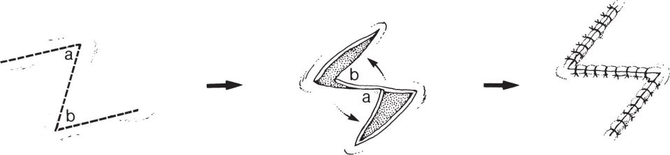 Plastic Surgery: Diseases Of The Skin And Soft Tissue, Face, And Hand ...