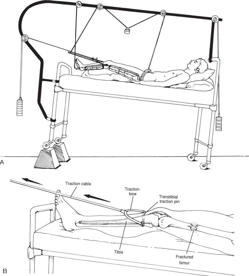 Orthopedic Surgery: Diseases Of The Musculoskeletal System ...