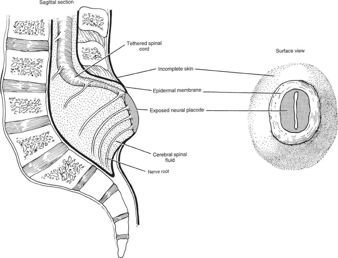 Neurosurgery: Diseases Of The Nervous System | Basicmedical Key