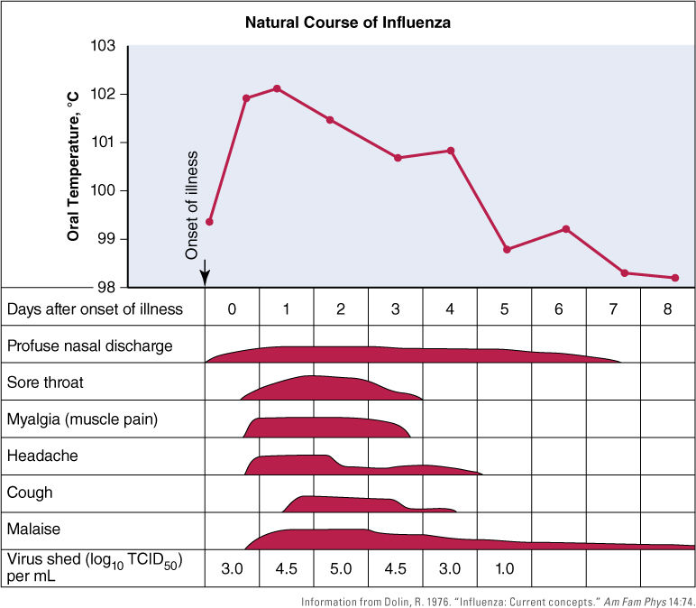 Influenza Viruses | Basicmedical Key
