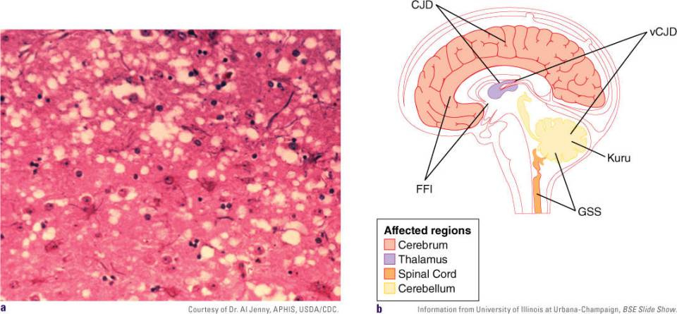 Infectious Molecules: prions and Viroids | Basicmedical Key