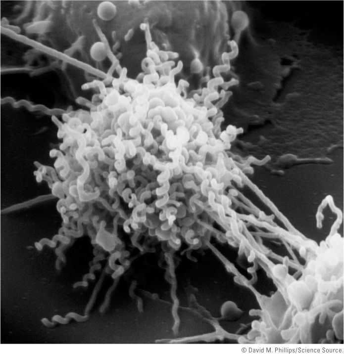 Infectious Molecules: prions and Viroids | Basicmedical Key