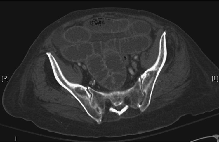 General Internal Medicine Board Review Questions | Basicmedical Key