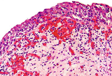 Urinary Tract Cytology | Basicmedical Key
